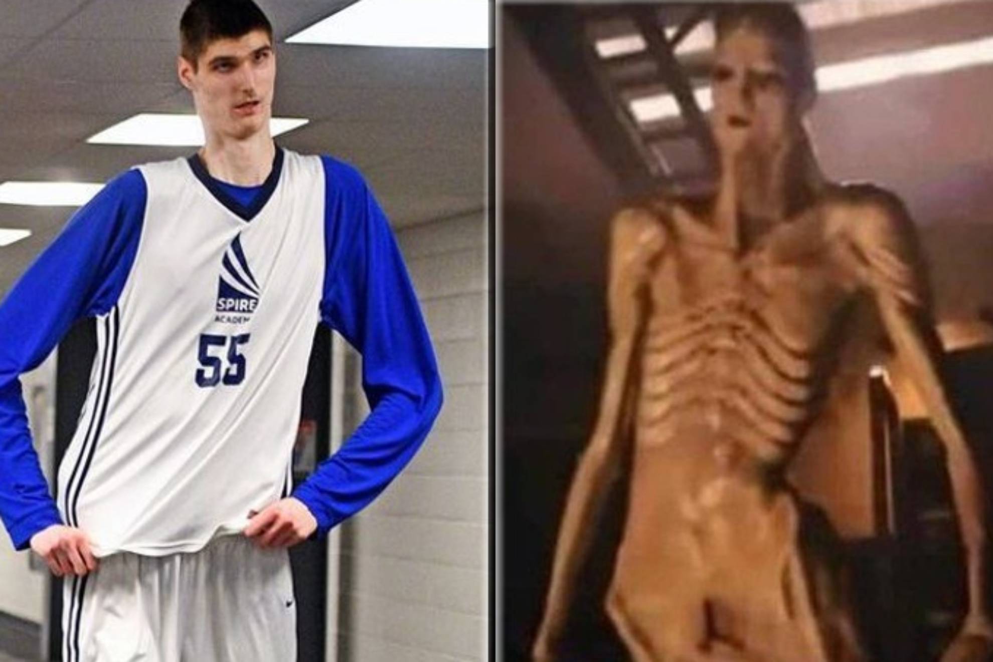 De ser el adolescente más alto del mundo y rechazar al Barcelona, a ...